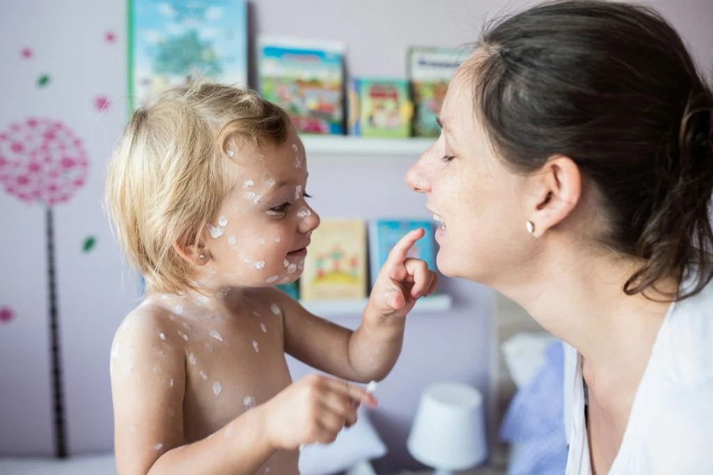 Autism And Skin Picking: Top 4 Life-Changing Strategies